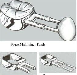 Space Maintainer Bands, DSC, Prestige Dental Products
