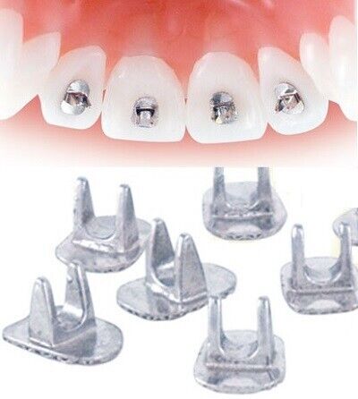 Tongue Tamers, Prestige Dental Products