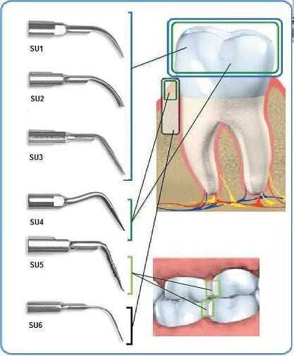Ultrasonic Piezo Tips (Vista)