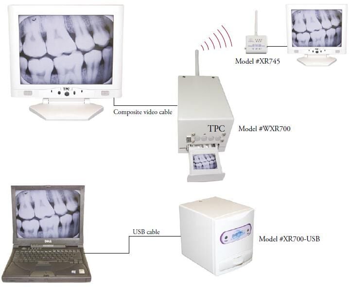 X-ray Film Reader, TPC, Dental Supplies